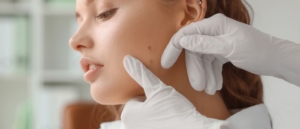 Recovery after Mole Removal - Cheshire Cosmetic Surgery